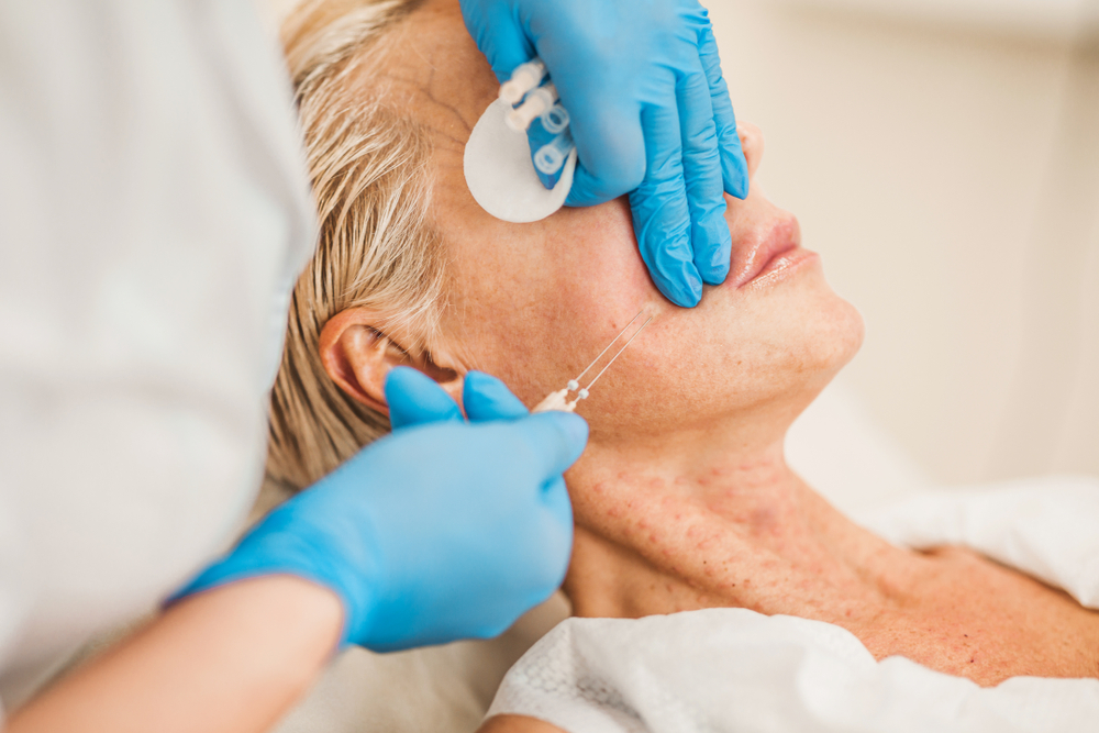 How to Choose the Right Type of PDO Threads for Your Skin | Lett