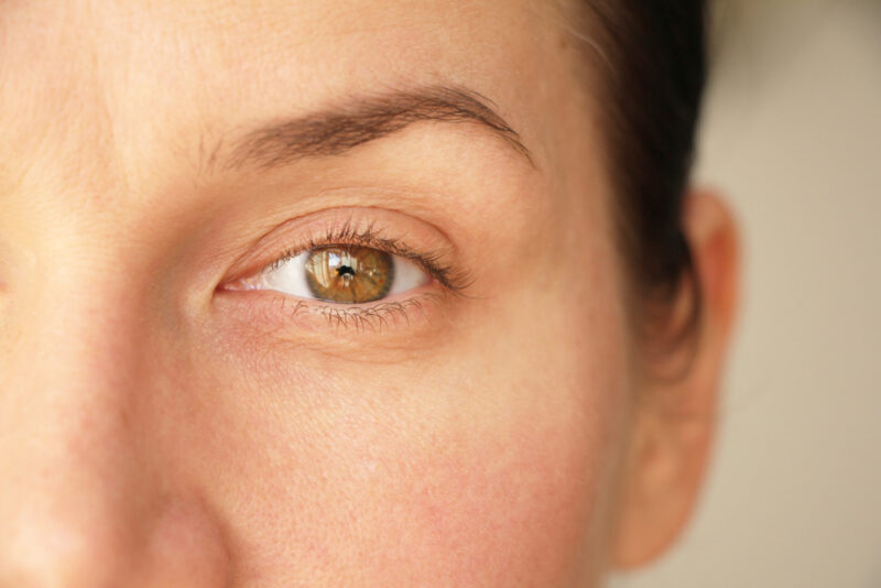 How to Fix Asymmetrical Eyes Naturally & Surgically | The Lett Center
